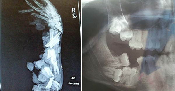 10 ภาพ "เอ็กซเรย์" ของคนซวยๆ ที่ไม่คิดว่าจะสยองได้ขนาดนี้ - เพชรมายา