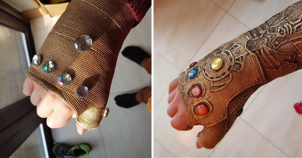 หนุ่มพลาดท่าทำตัวเองแขนหัก เปลี่ยนเฝือกตัวเองให้เป็นถุงมือธานอส - เพชรมายา