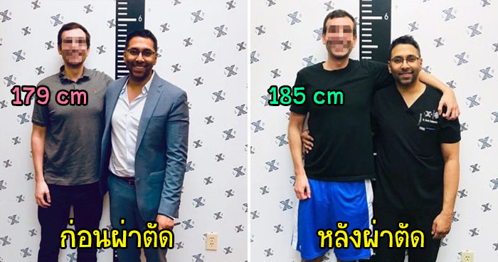คลินิกแห่งนี้สามารถผ่าตัดยืดขา เพื่อทำให้คุณสูงขึ้นอีก 15 เซนติเมตร ...